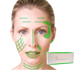 9 Marcas de Ácidos Hialurônicos Vendidas no Brasil